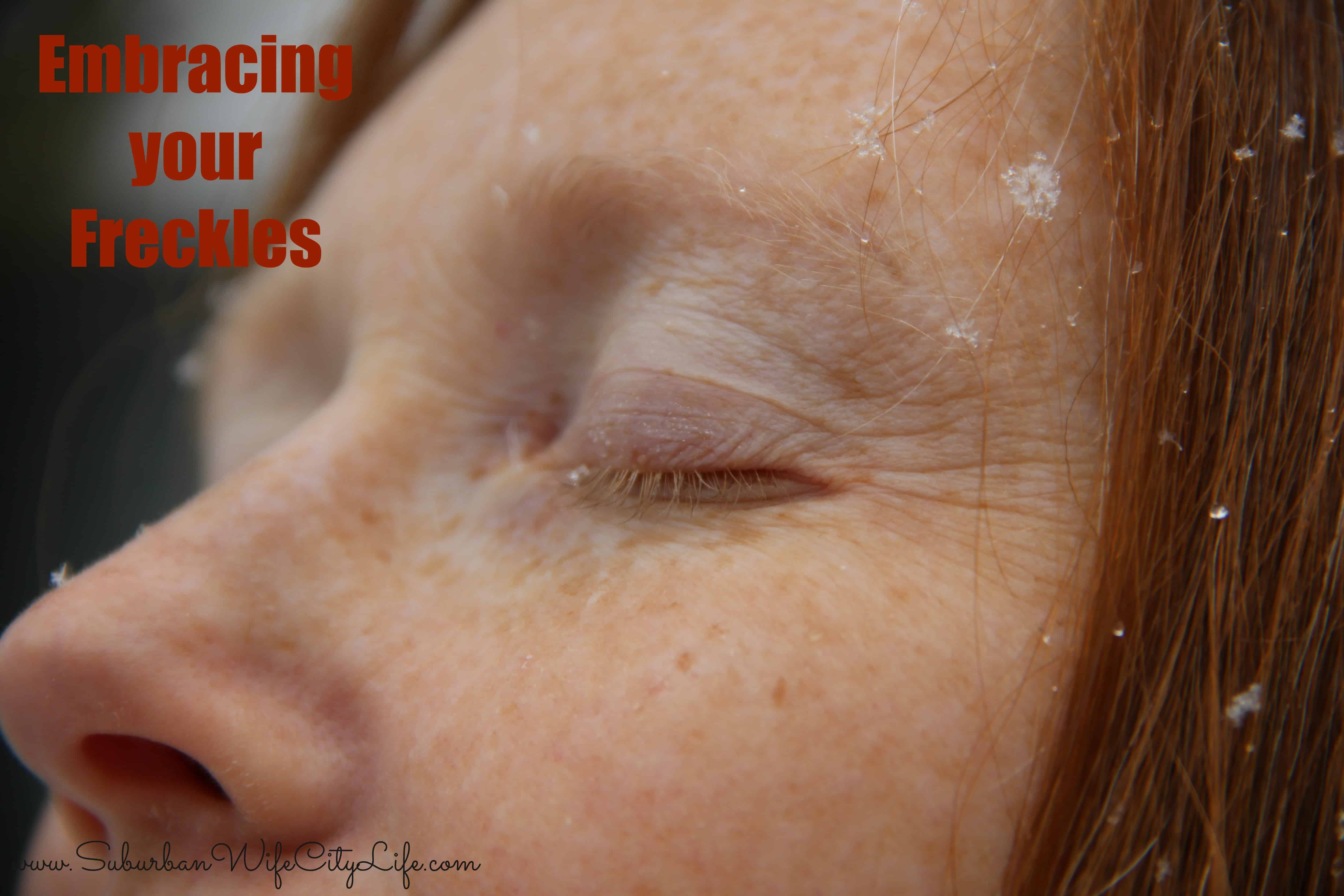 Embracing your Freckles - Suburban Wife, City Life Embracing your Freckles - Suburban Wife, City Life